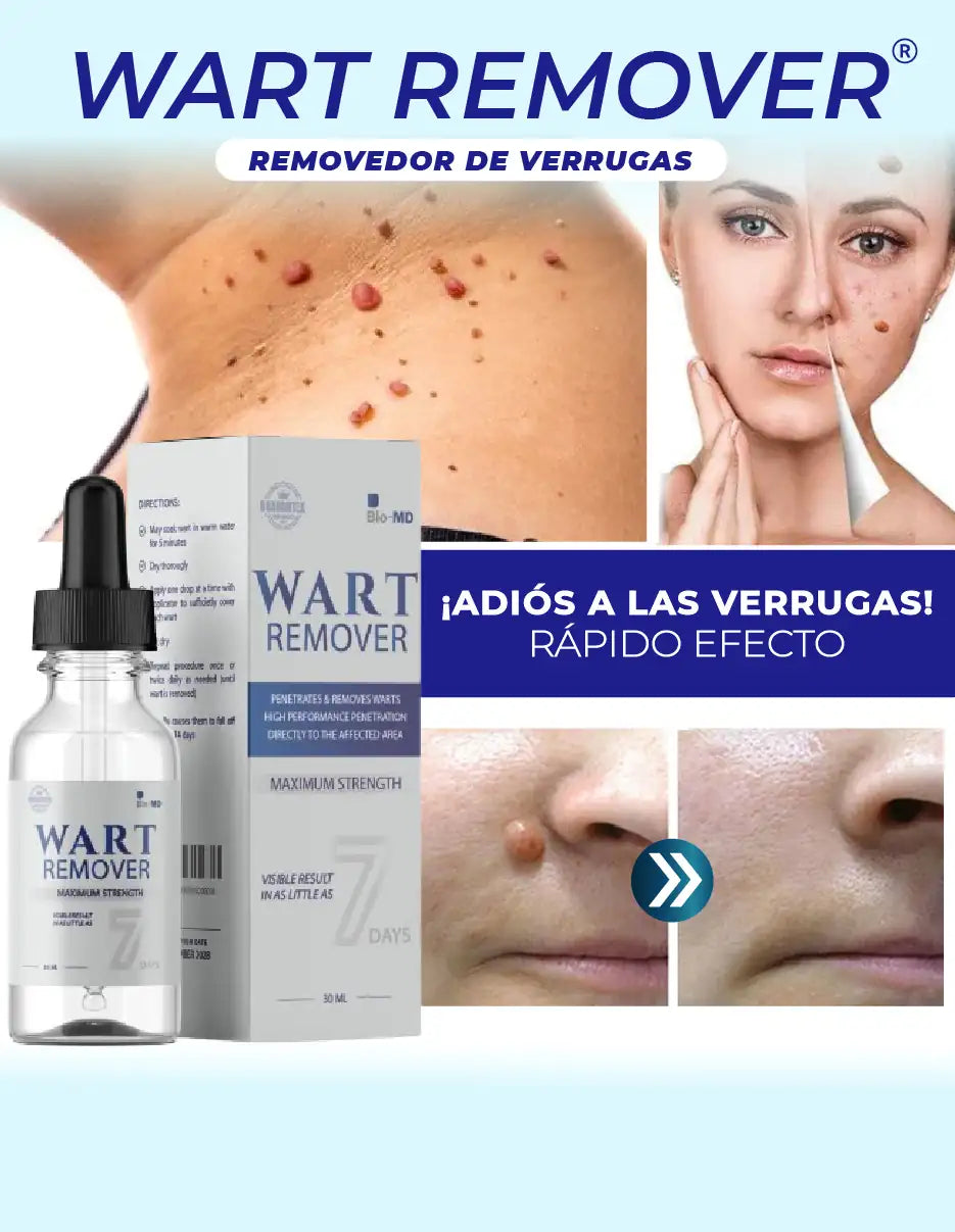 REMOVEDOR DE VERRUGAS WART REMOVER [PV1-META-QUETZAL] – Quetzal Salud-GUA